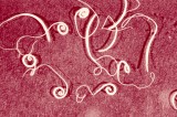 Autism: Parasitic Worms May Be Promising New Treatment - Guardian ...