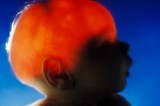 Miracle Child Born Without a Brain Has Died 12 Years Later [Video ...